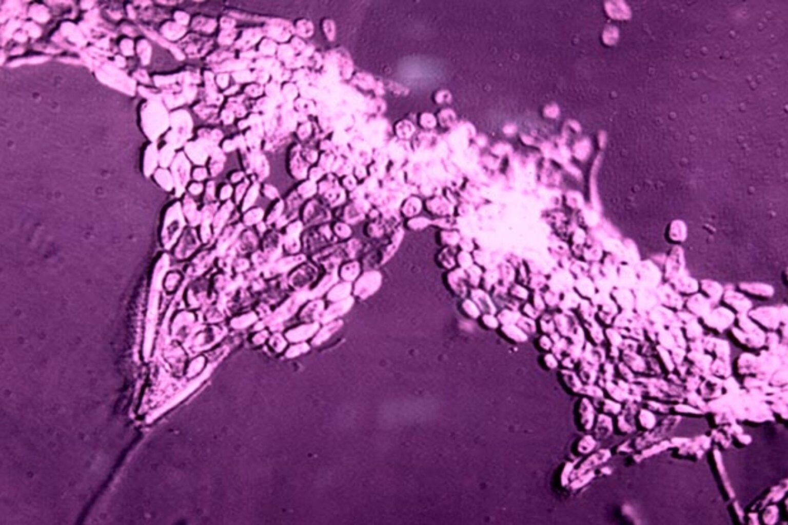 Grzybica penisa: Jak rozpoznać, leczyć, zapobiegać infekcjom