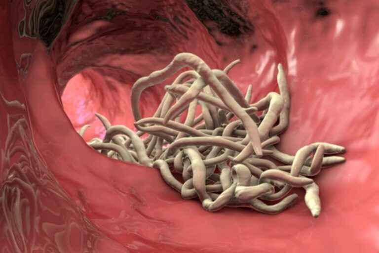 Glistnica: Objawy, Leczenie i Zapobieganie