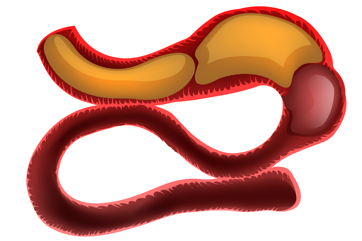 Glistnica: Objawy, Leczenie i Zapobieganie